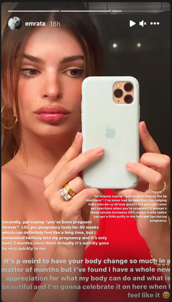 Emily Ratajkowski Cites Pregnancy as Reason for 'Puffy' Lips After ...