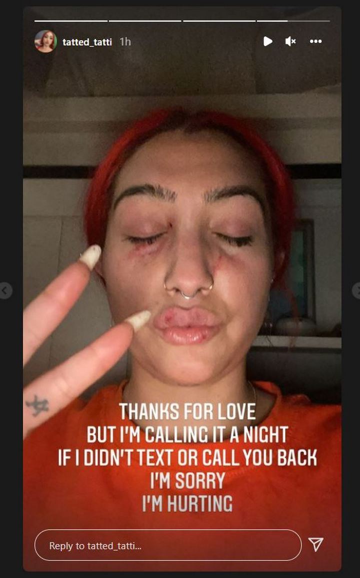 'Black Ink Crew' Star Tatti Shows Her Bruised Face After Getting ...