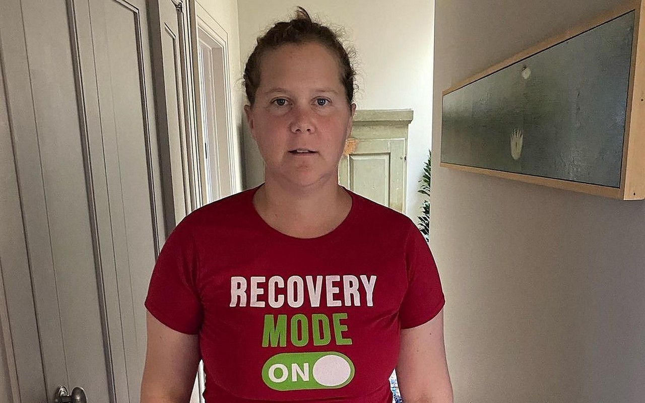 Amy Schumer Gets Rid of Face Fillers for Making Her 'Look Like Maleficent'