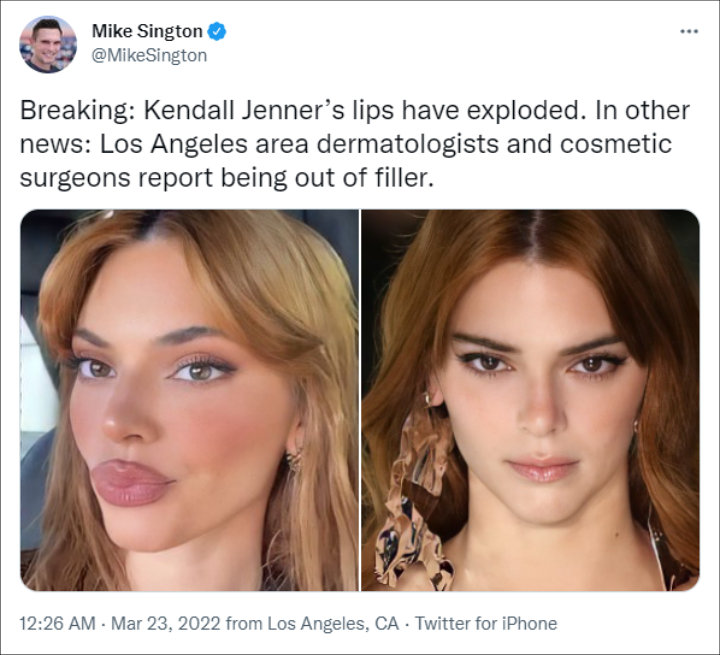 Kendall Jenner Mocked for Her 'Exploded' Lips in New Instagram Post