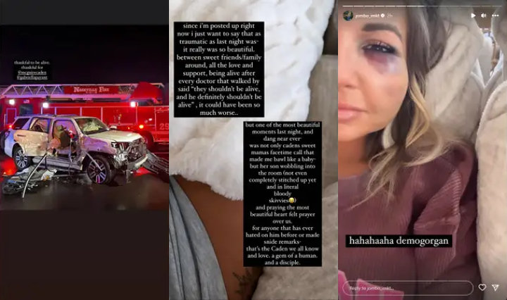 Morgan Wallen's Ex Shares Photos of Gnarly Facial Injuries Following ...
