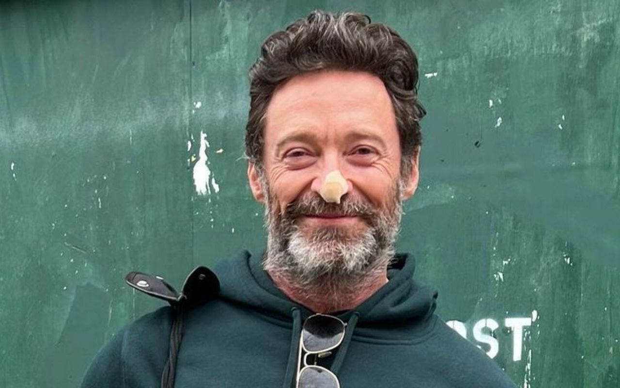 Hugh Jackman Is Cancer-Free Following Two Biopsies