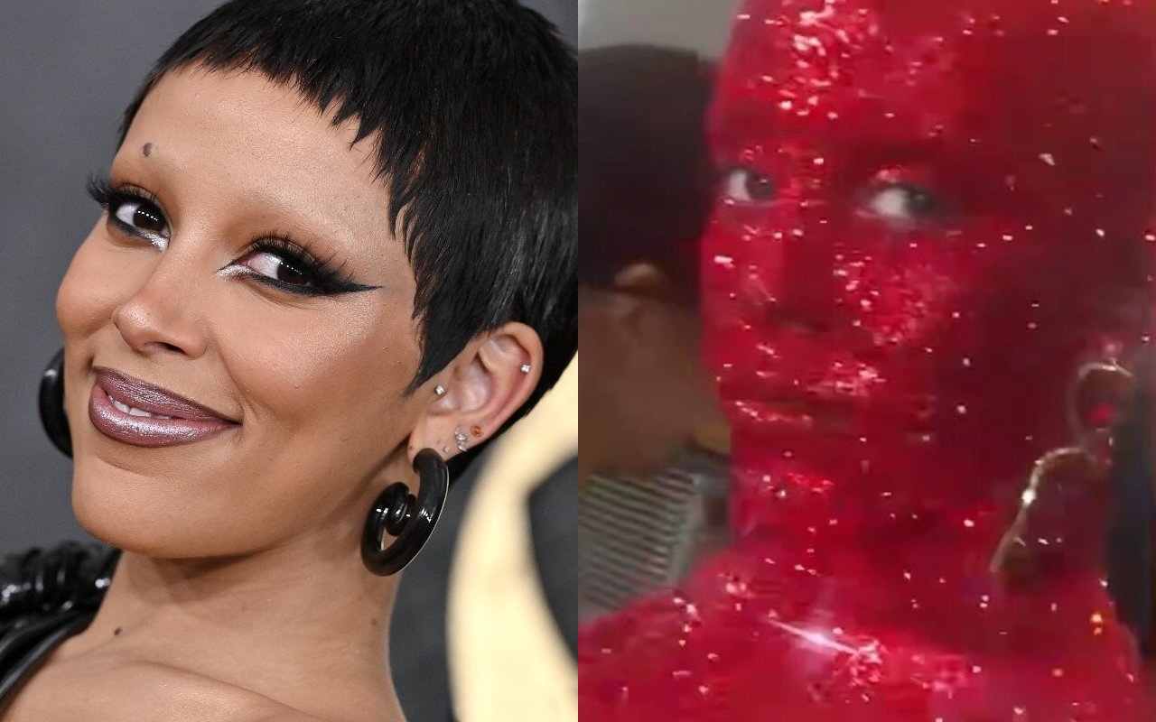 Doja Cat Crippled by Painful Gastroenteritis Before Debuting Swarovski ...