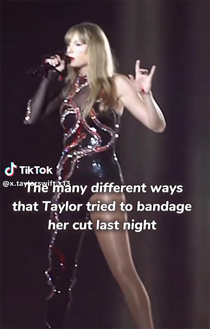 Taylor Swift Assures She's 'Totally Fine' After Fans Notice Her Hand Injury