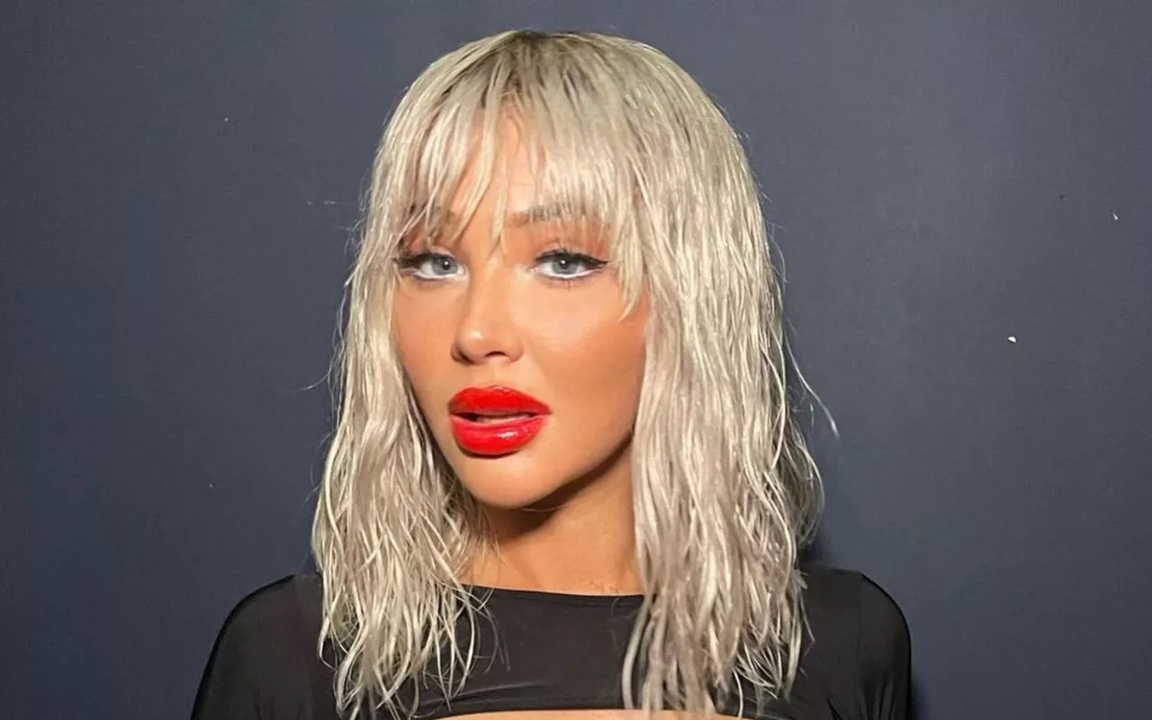 N-Dubz's Tulisa Contostavlos Struggles to Live With Bell's Palsy