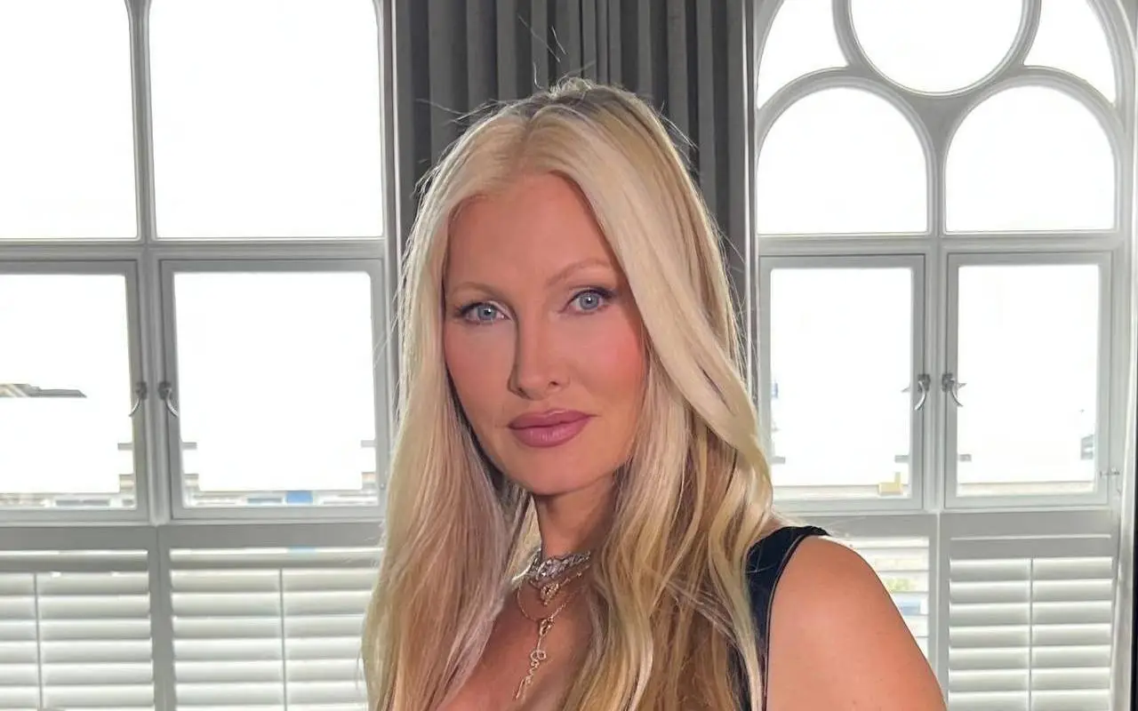 Caprice Disgusted by Her Own Look After Botched Cosmetic Procedure