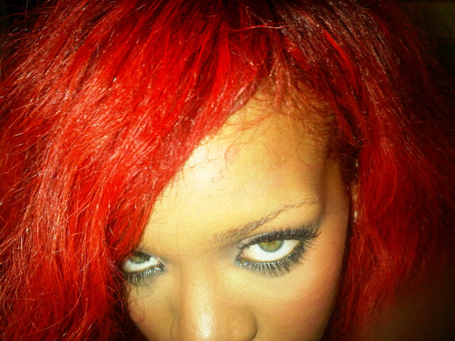 Rihanna Posts Pic of Her Burnt Forehead